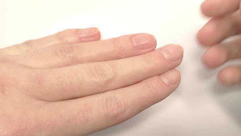 Iron Deficiency Anemia Nails A New Cell Phone App Detects Anemia